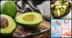 How Avocado Helps With Constipation | Dr Farrah MD
