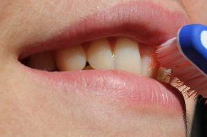 What Can Turmeric Do For Our Teeth And Gums? | Dr Farrah MD