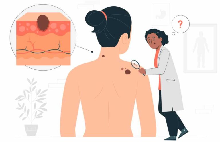 These 3 Skin Conditions Can Be Precursors To Cancer Dr Farrah Md